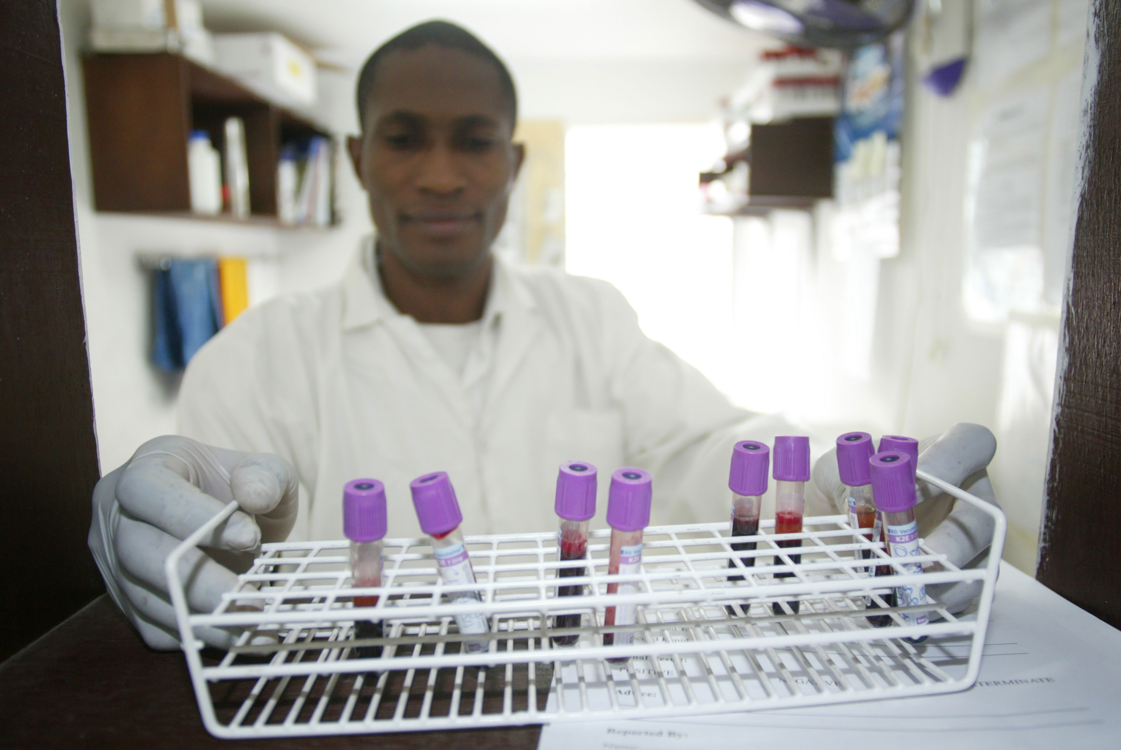 Undetectable: How Viral Load Monitoring Can Improve HIV Treatment in ...