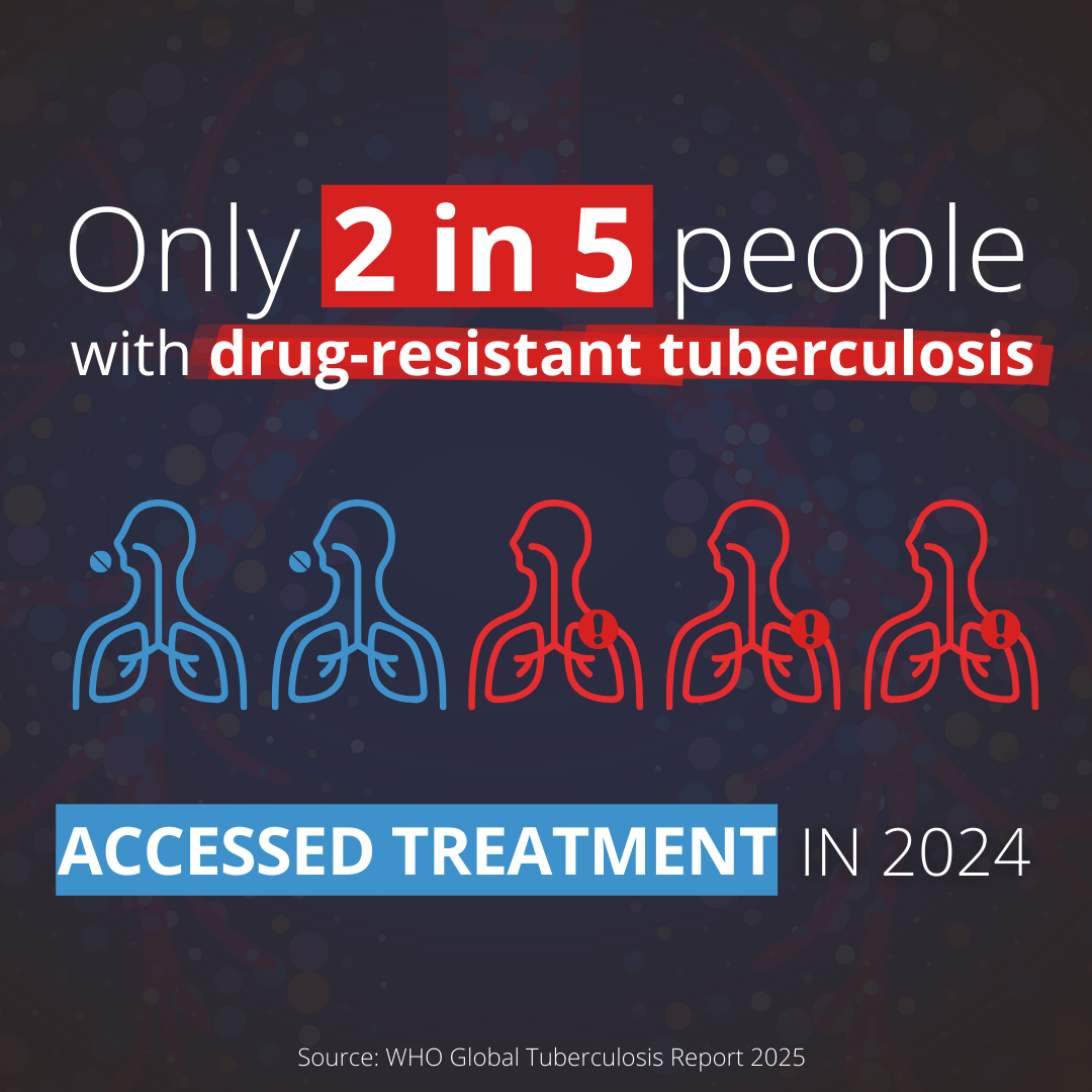 Living With Tuberculosis