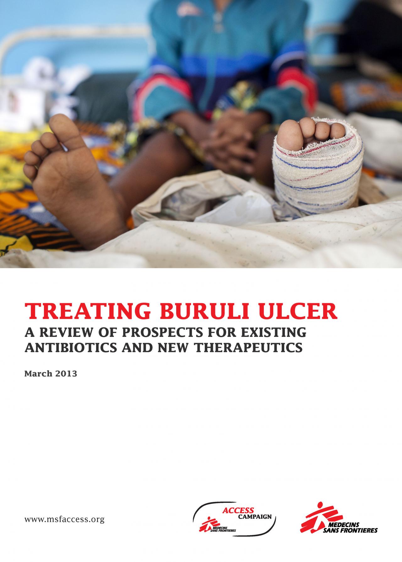 Treating Buruli Ulcer: A Review of Prospects for Existing Antibiotics ...