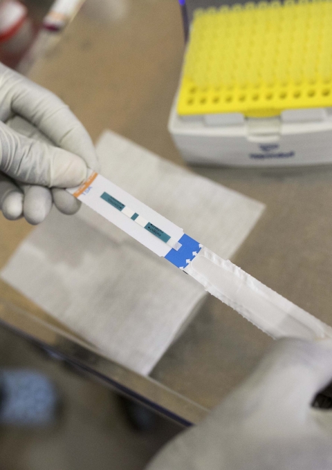 A rapid TB test for people living with HIV | MSF Access